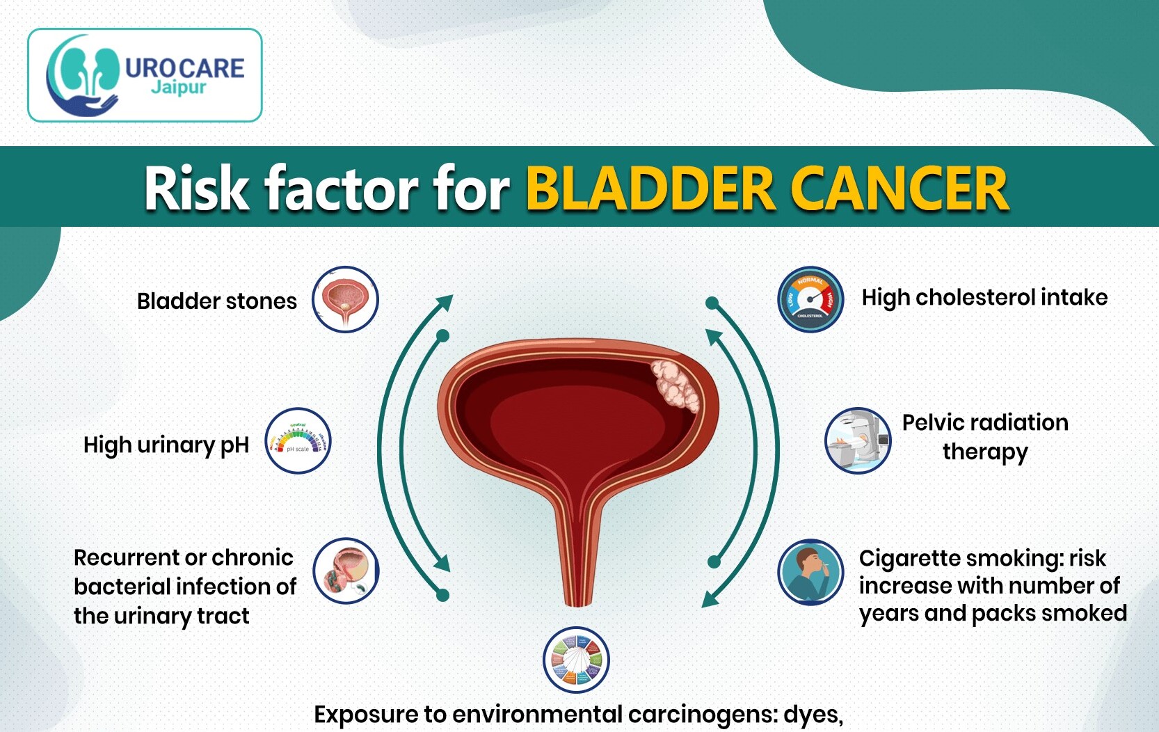 How Smoking Increases the Risk of Bladder Cancer? - Dr. Lokesh sharma
